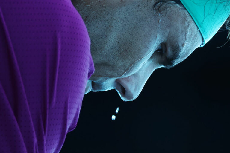 Hladni znoj i kako ga spriječiti